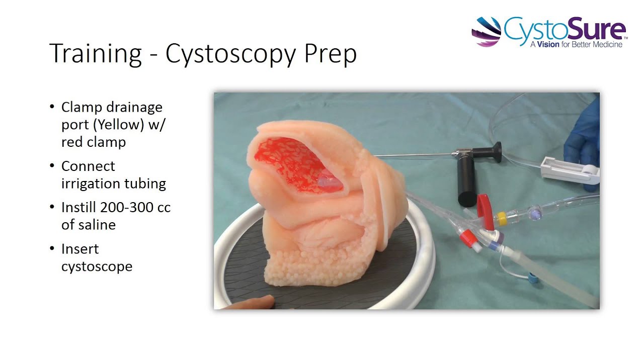 Cystoscopy Preparations - YouTube