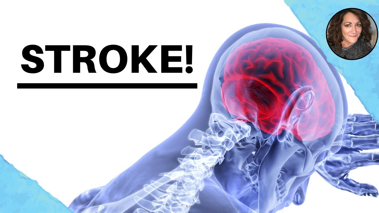 How To-SURVIVE A STROKE! - YouTube