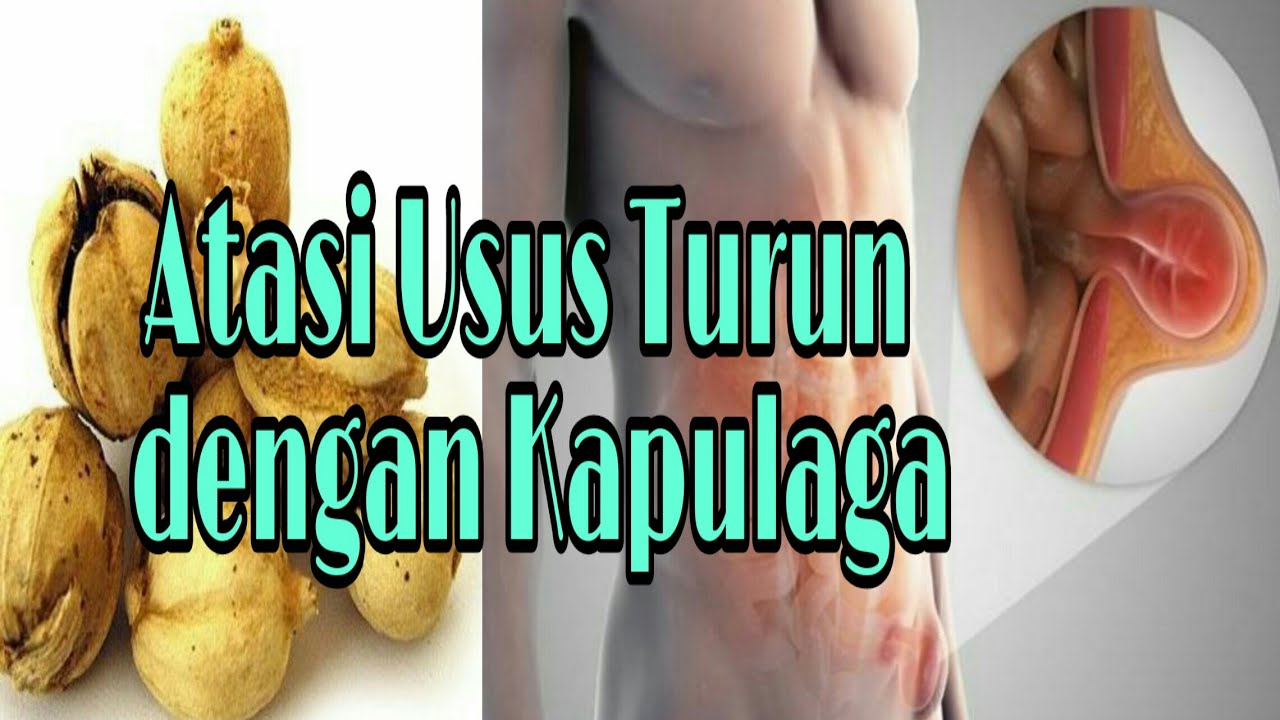 Mengatasi usus turun dengan kapulaga - YouTube