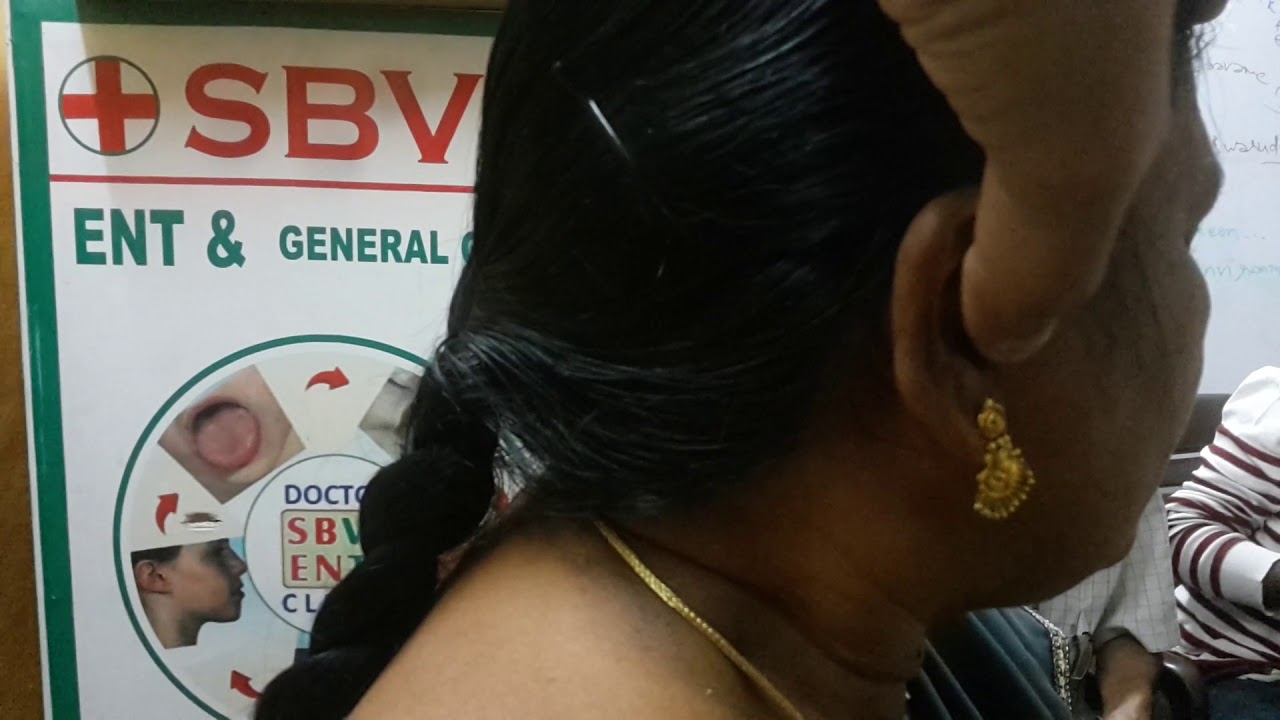 Furunculosis -Tragal sign - YouTube