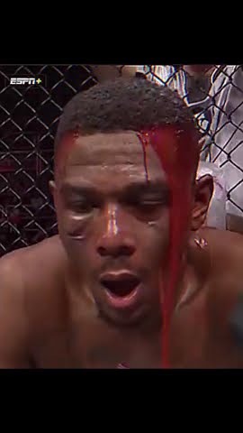 Jamahal hill bleeding 🔥 #mma #ufc #fight - YouTube