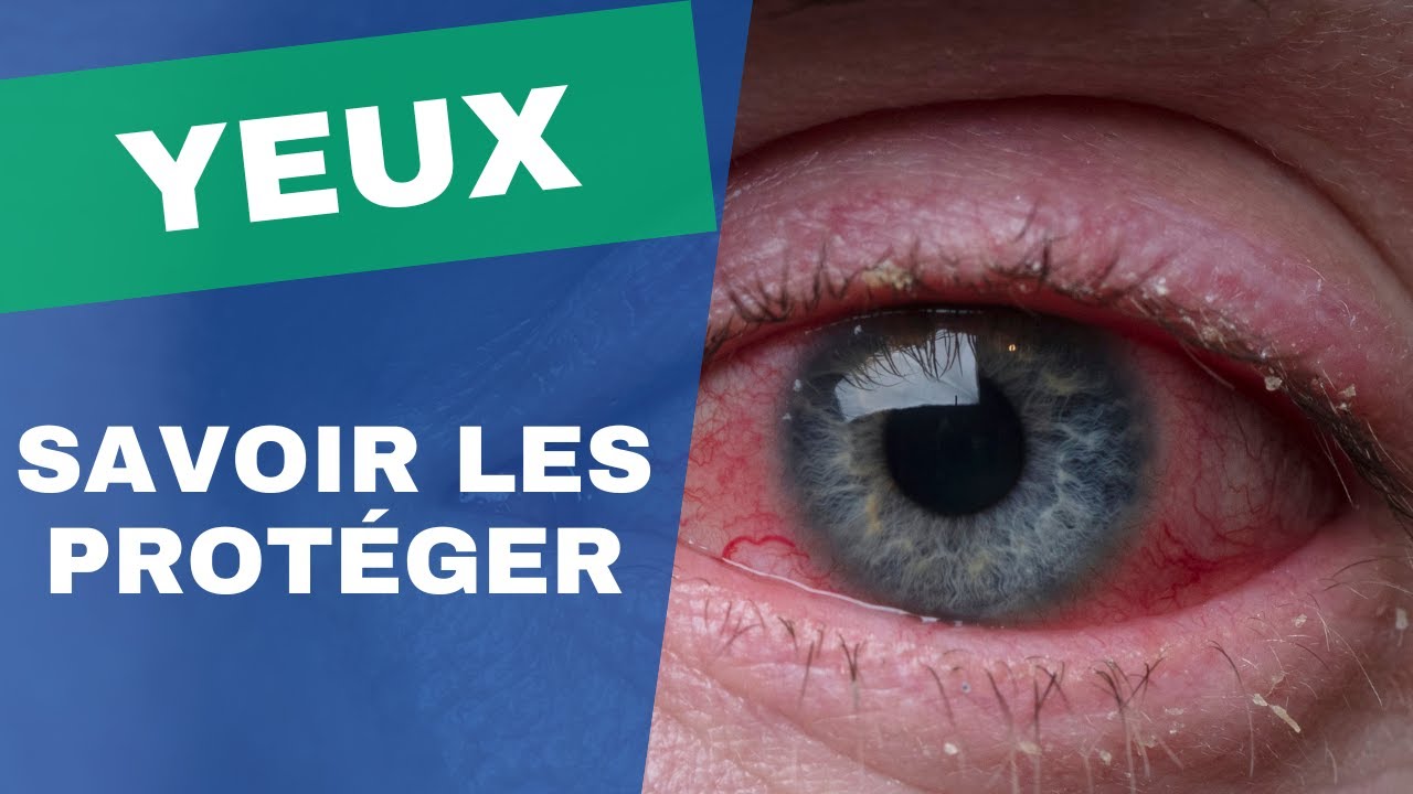 Protégez votre vision : 6 SUPERS ALIMENTS efficaces pour améliorer naturellement la santé des ...