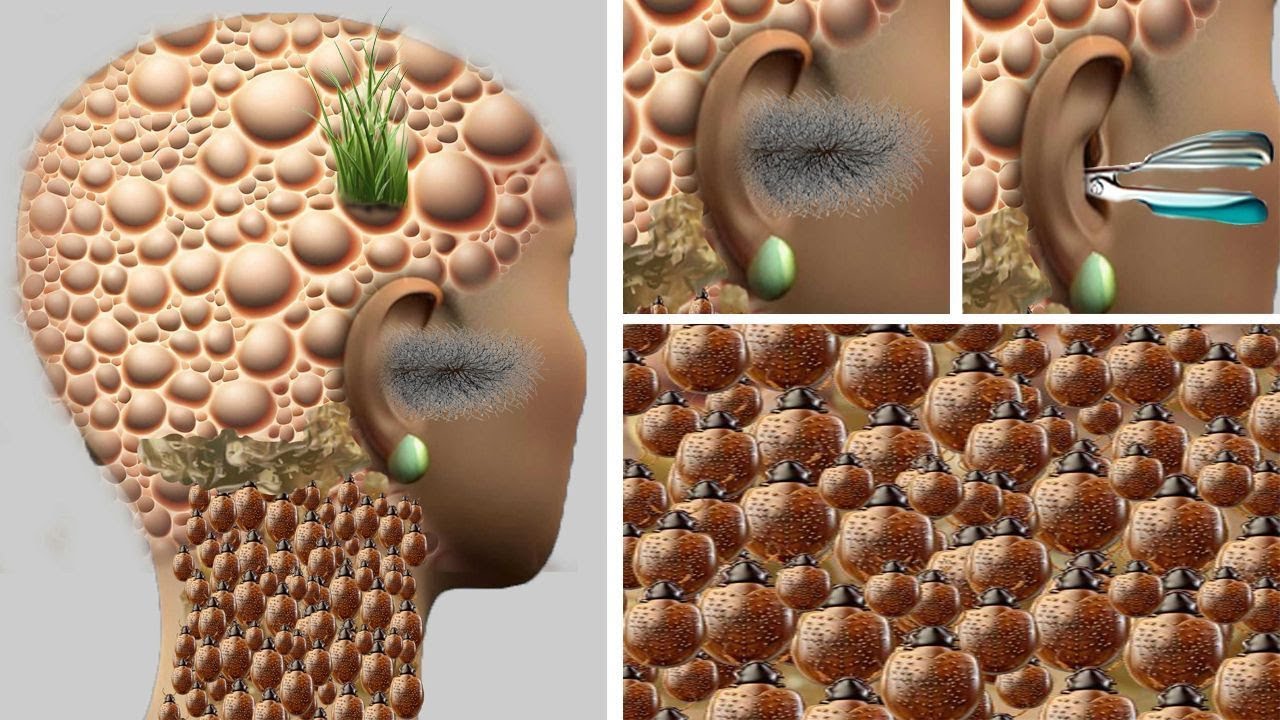 ASMR Animation treatment - YouTube