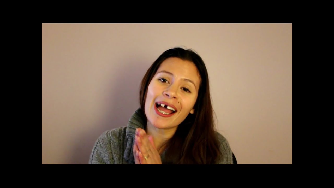 One Month Post Op Surgically Assisted Rapid Palatal Expander - YouTube