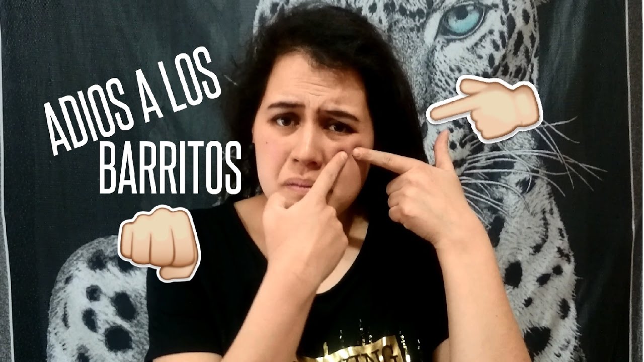 ¿Cómo quitar Barros?- Super fácil - YouTube
