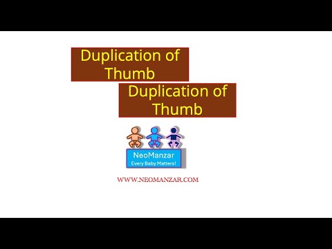 Duplication of Thumb - YouTube