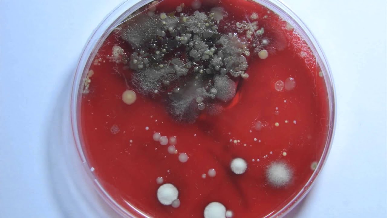 Bacteria Growth Time Lapse - YouTube