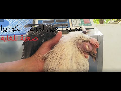 عملية العين لمرض الكوريزا صعبة للغاية