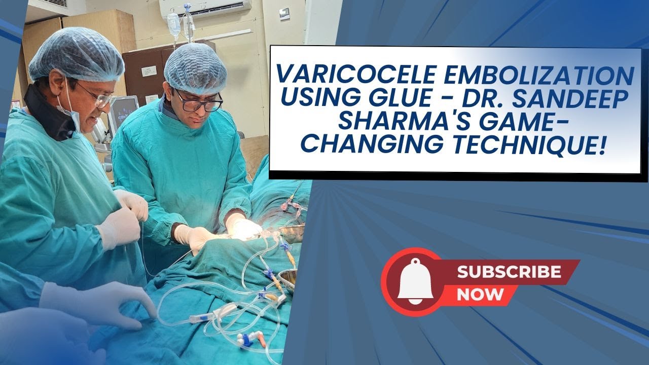 Varicocele Embolization Using Glue - Dr. Sandeep Sharma's Game-Changing ...