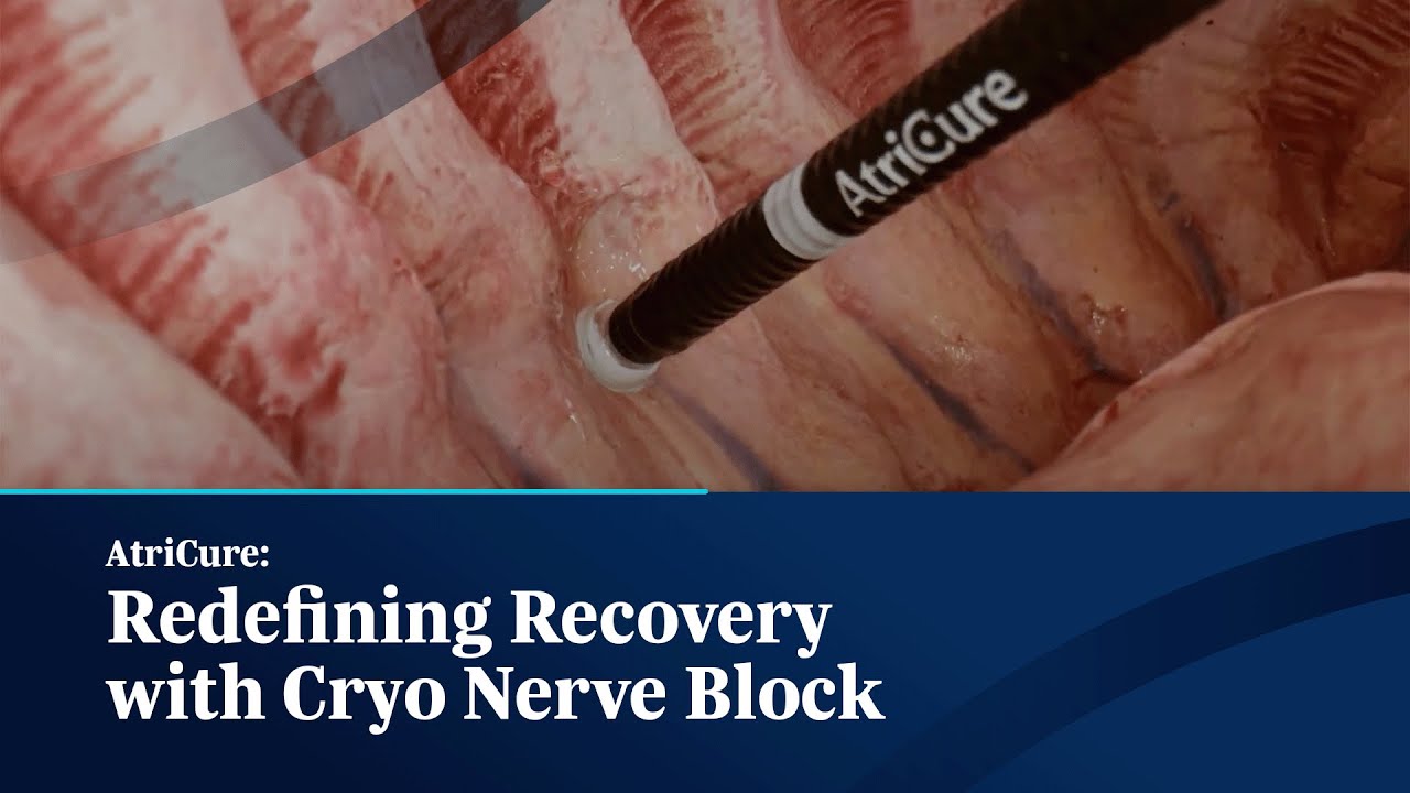 Cryo Nerve Block: A Non-Opioid Solution for Post-op Pain Management ...