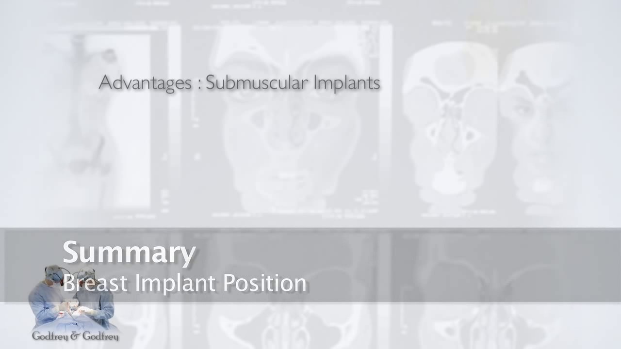 Breast Implants: Above Or Below Muscle? - YouTube