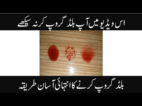 B Positive: Blood Grouping Test Procedure - YouTube