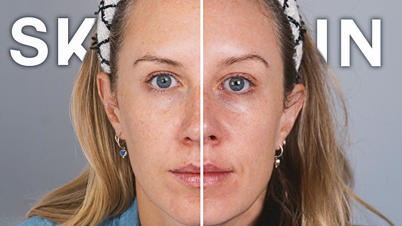 Reverse Sun Damage and Fade Pigmentation - YouTube