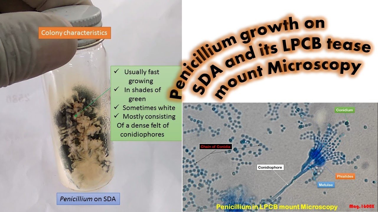 Penicillium growth on SDA and its LPCB tease mount Microscopy - YouTube