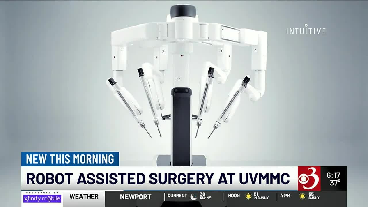 UVMCC launches second robot to assist in surgery - YouTube