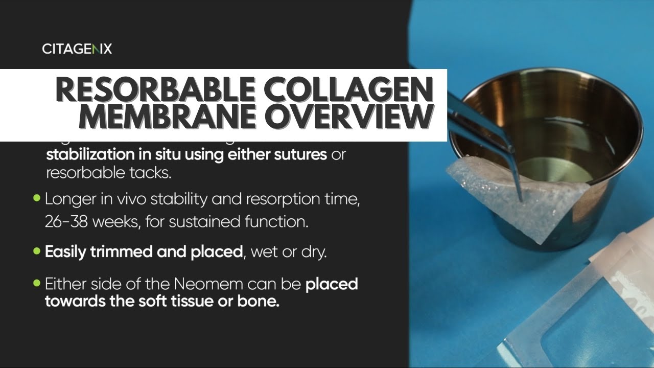 Resorbable Dental Collagen Membrane - Neomem [Overview] | Citagenix ...