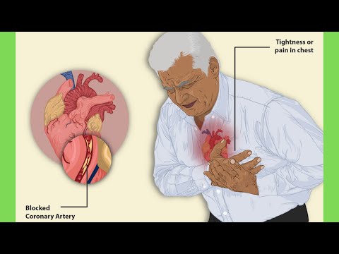 Widowmaker heart attack: Everything you need to know. : u/pathana_khan