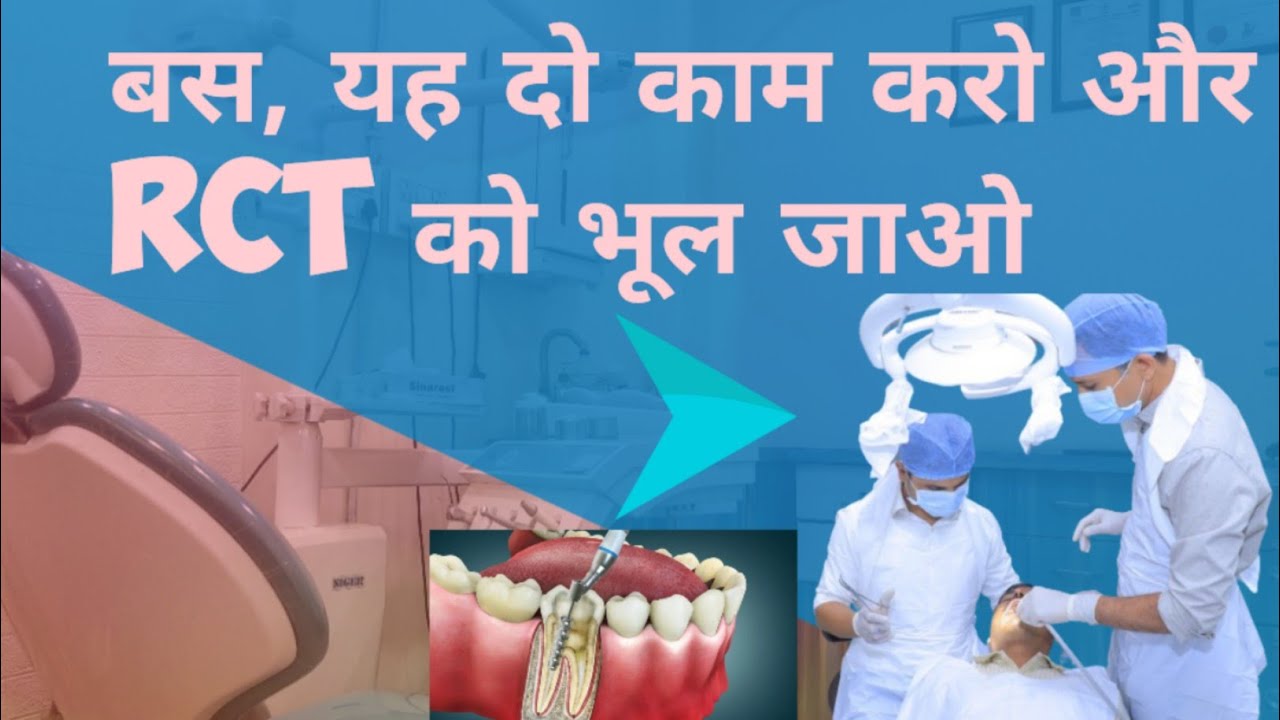 How To Avoid Root Canal Treatment?How To Get Rid Of Root Canal ...