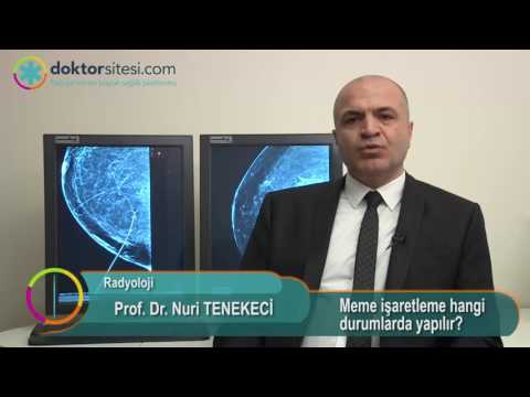 Meme işaretleme hangi durumlarda yapılır?