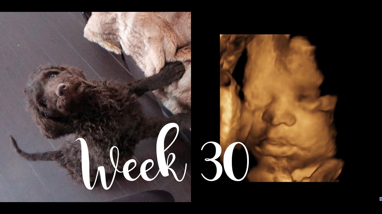Week 30! - Pregnancy Update | 3D Scan, Cone Shape Belly & Being Anti ...