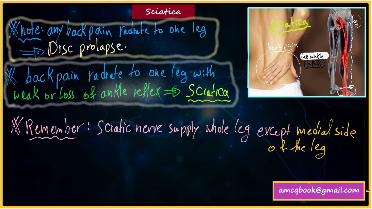 Sciatica,subacute combined degeneration and reflexes notes for ...