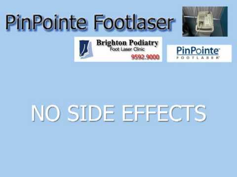 Pinpointe Footlaser Melbourne - YouTube