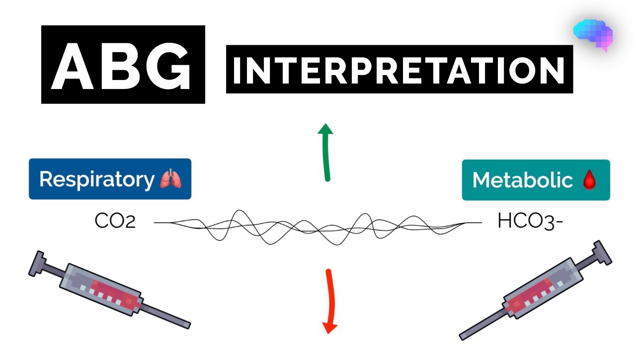 ABG Interpretation Understanding Arterial Blood Gas Analysis OSCE