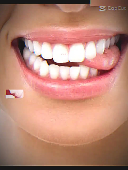 Biting Your Tounge Youtube
