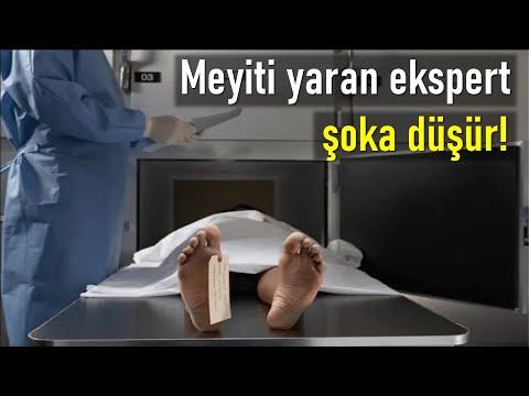 AXI BU NECƏ OLA BİLƏR?!