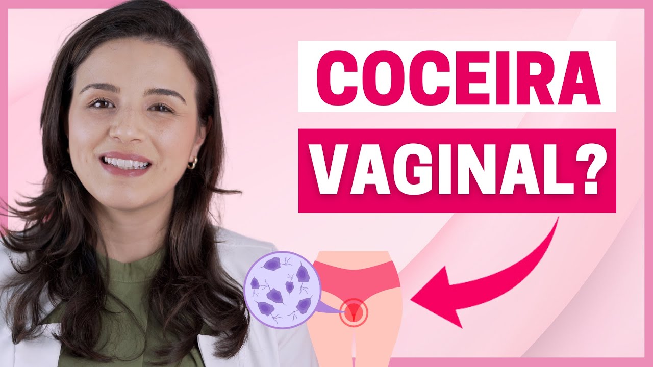 CINCO PRINCIPAIS CAUSAS DA COCEIRA VAGINAL: O GUIA DEFINITIVO PARA A SUA SAÚDE ÍNTIMA! - YouTube