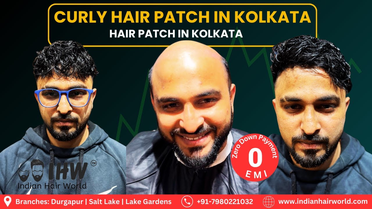 Curly Hair Patch in Kolkata | 0 Down Payment EMI on Hair Patch | Indian ...