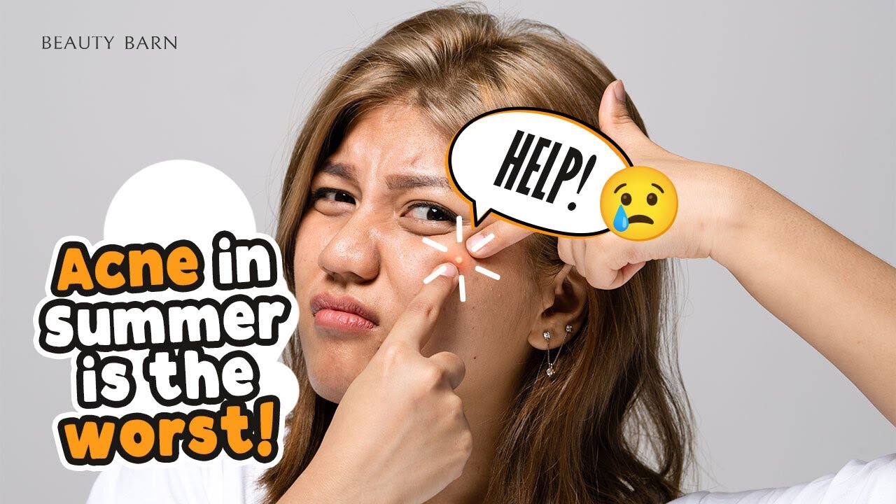 Why do you get (more) pimples in Summer? 3 reasons for summer acne ...
