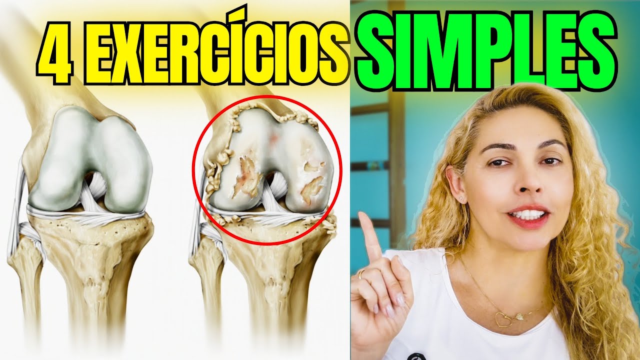 Artrose: o que realmente causa a dor (e como aliviar de forma segura ...