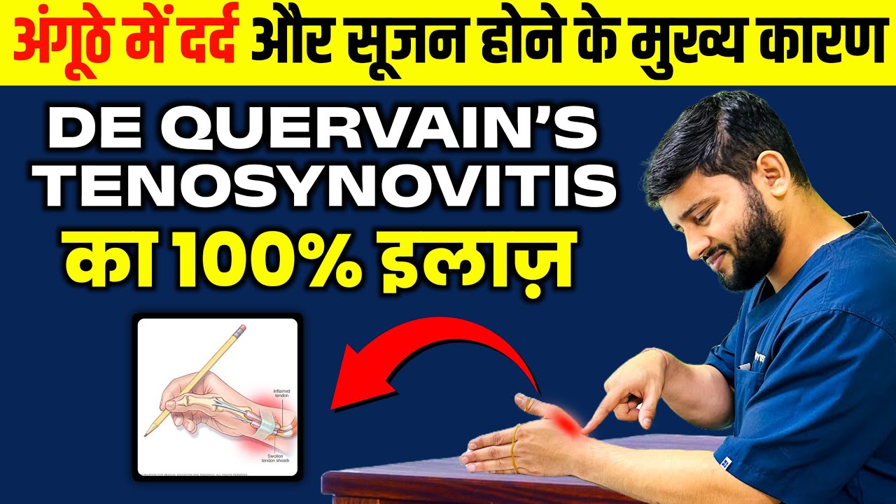 Fix De Quervain's Tenosynovitis/Texting Thumb Syndrome With These 7 ...