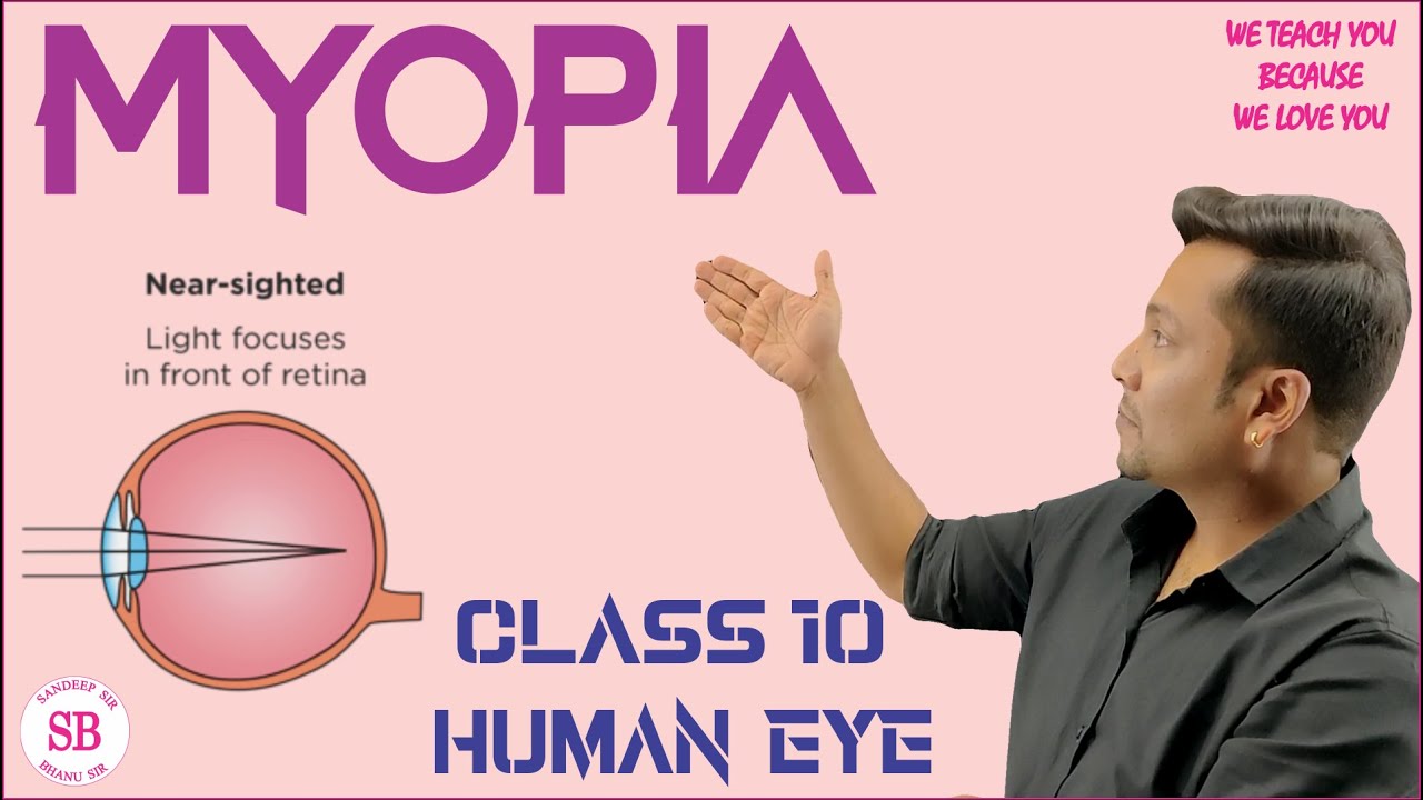 Human eye | Class 10 | Physics | Myopia - YouTube