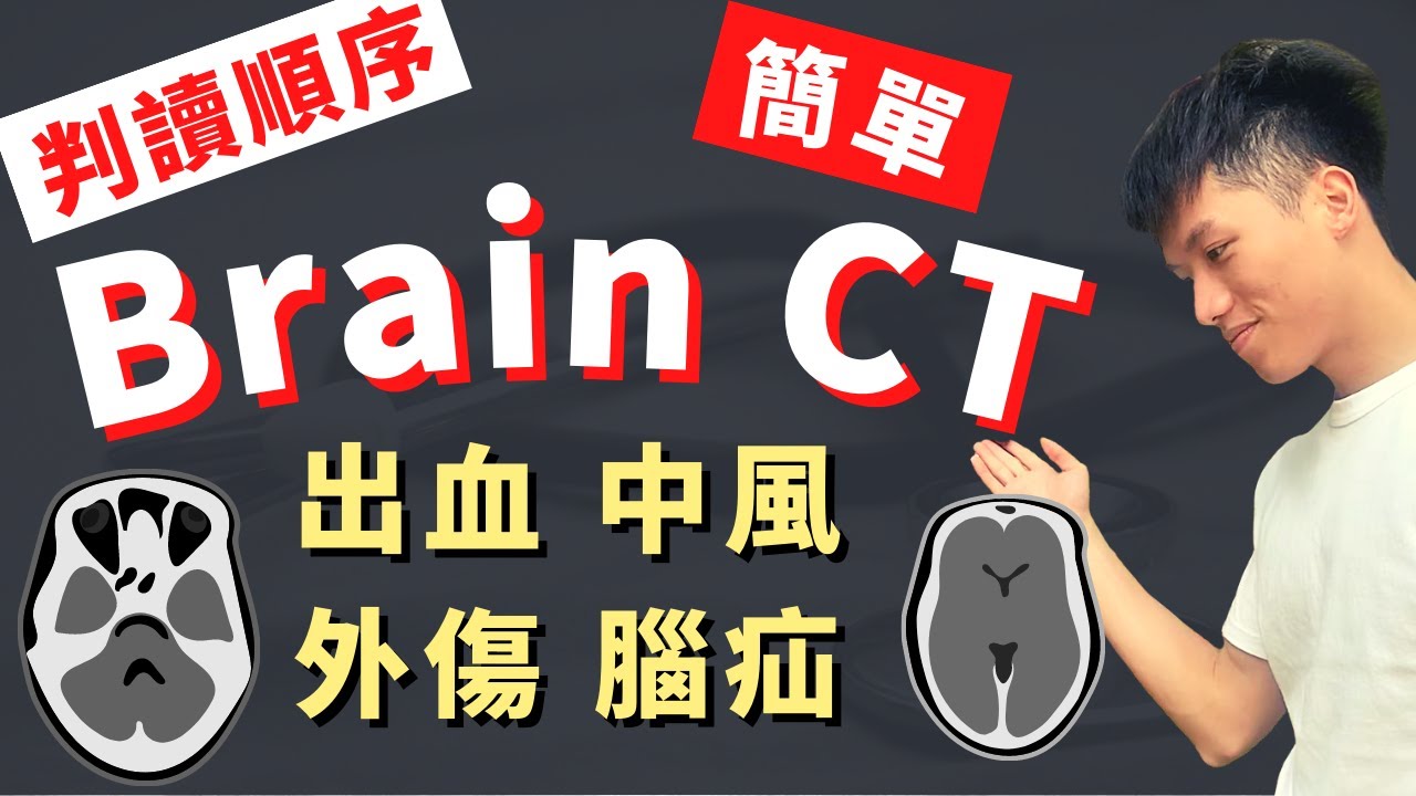 【brain Ct判讀】你只需要看這部!一次搞懂腦部電腦斷層!如何不會遺漏brain Ct上重要的病灶?出血、中風、外傷、mass