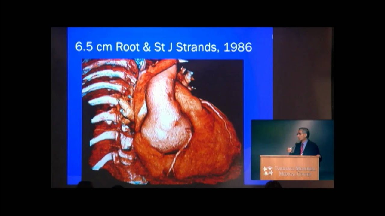 Prosthetic Aortic Valve, Stroke, Strands, Aneurysms - YouTube