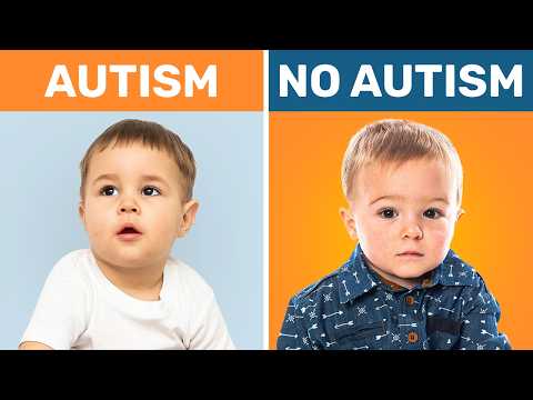 10 Subtle Signs Of Autism Most Parents Miss