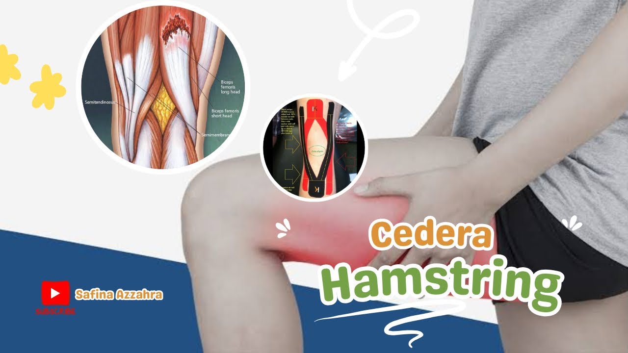 Cedera Hamstring | 6211422067 | Safina Azzahra - YouTube
