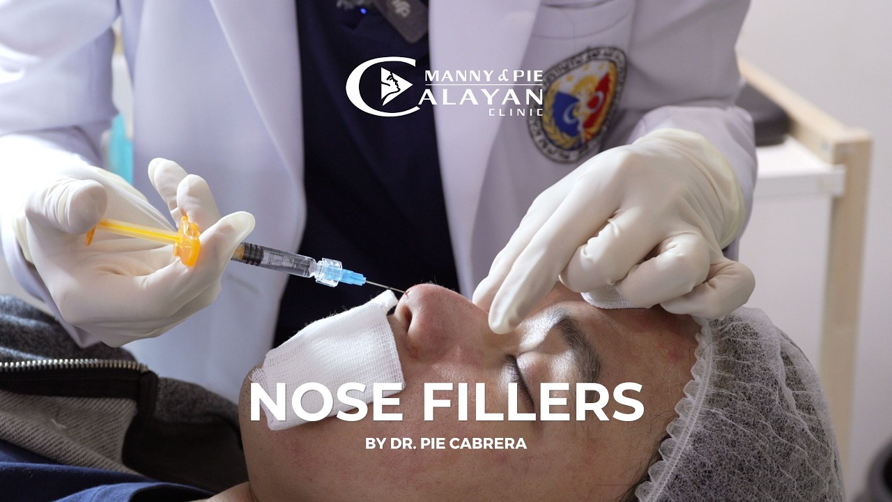 Brigiding's Nose Makeover Without Surgery! | Alartox + Filler by Dr ...