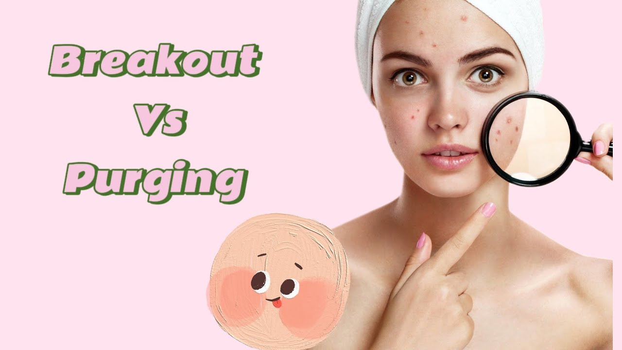 Breakout Vs Purging - YouTube