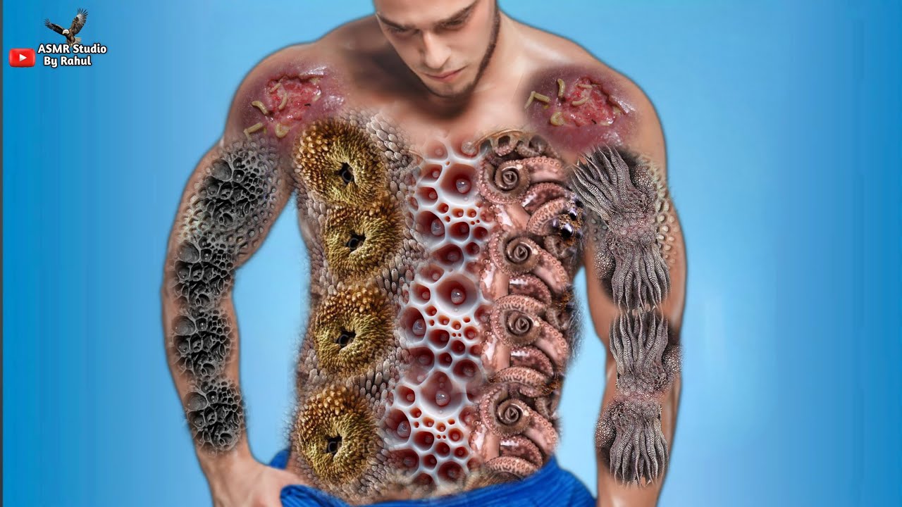 ASMR Remove dog tick ,Maggots ,spider ,lice, Barnacle from infected ...