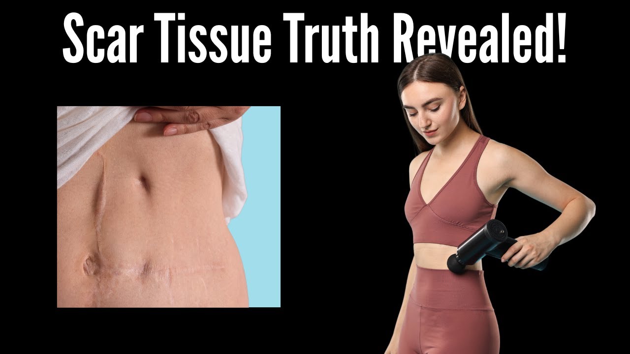 The TRUTH About Massage Guns and Scar Tissue Removal - YouTube