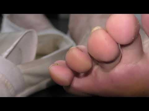 Sweaty stinky feet a lot of toe jam between my toes - YouTube