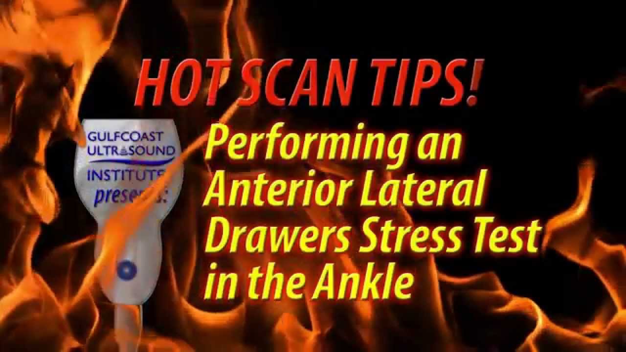 Hot Tip - Performing an Anterior Lateral Drawers Stress Test in the ...