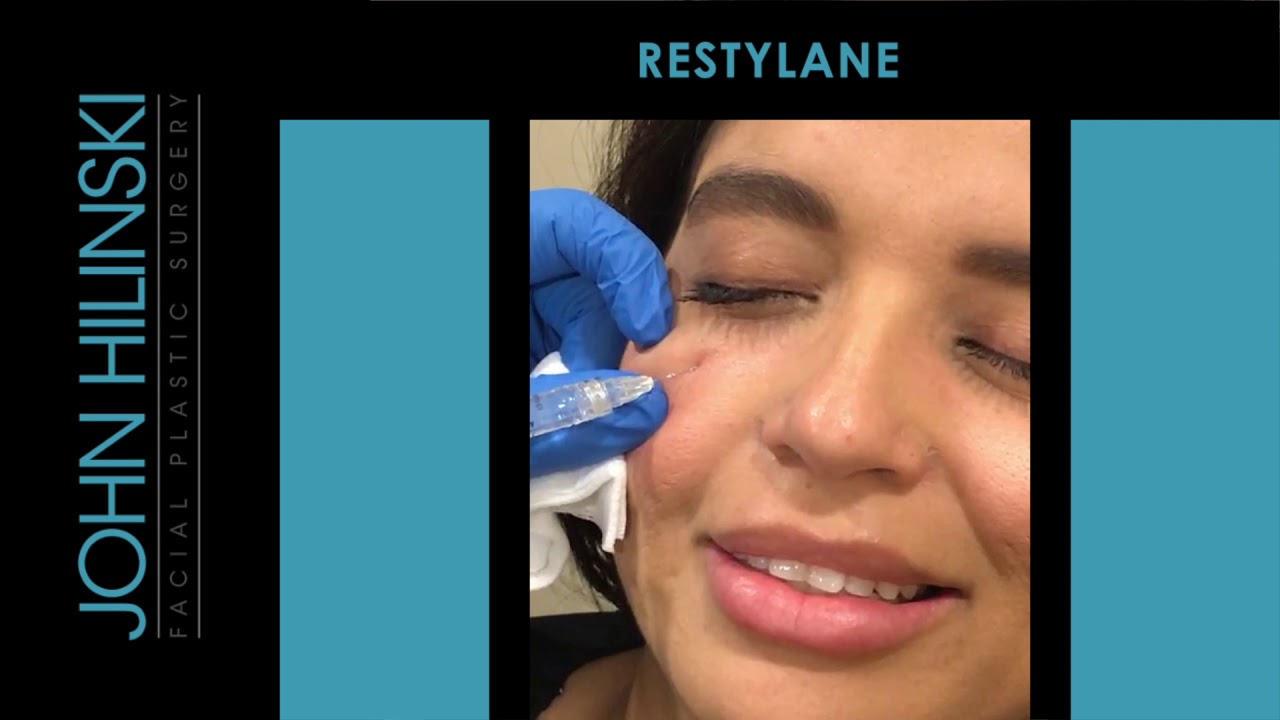 Lower Eyelid Filler Injection with Restylane - YouTube