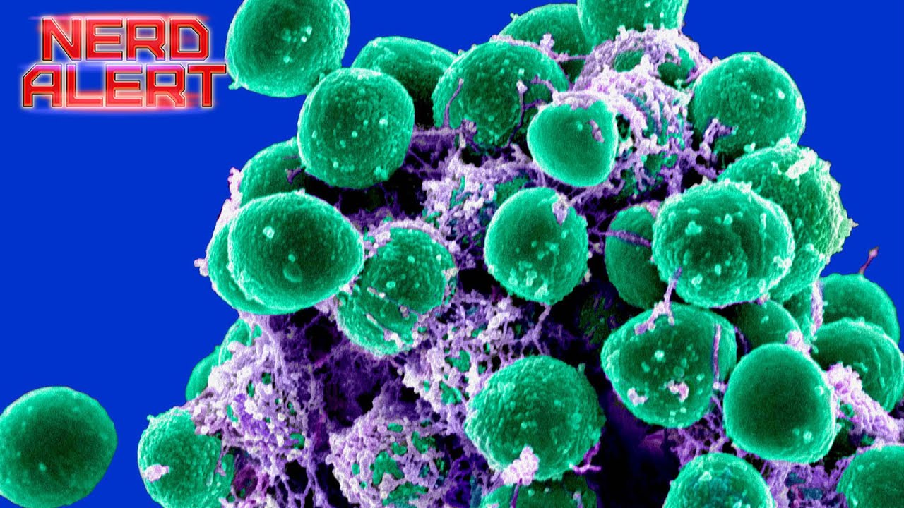 Weird 1,000 Year-Old Recipe Kills MRSA (Staph) Superbug - YouTube