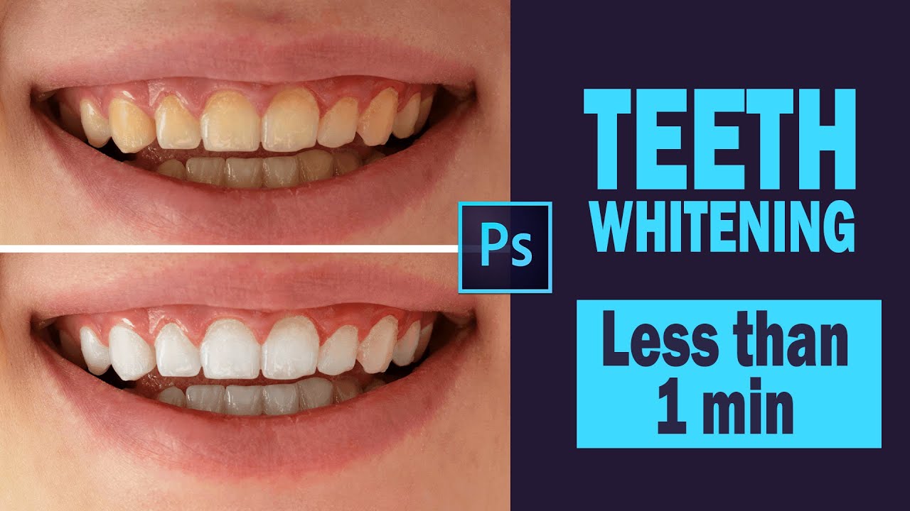 How to WHITEN TEETH in Photoshop | Retouching Tutorial - YouTube