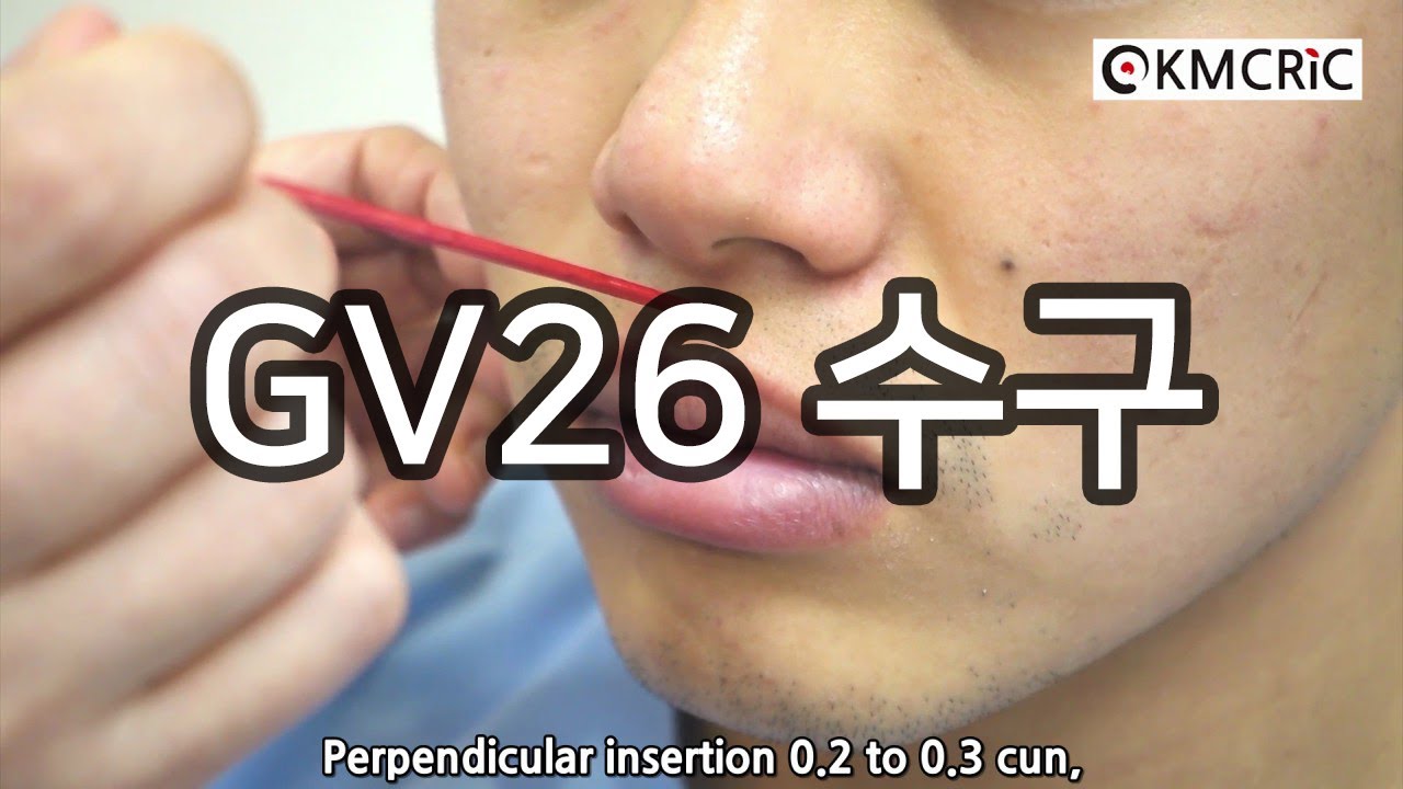 GV26 수구 水溝 Shuigou (Eng sub) - KMCRIC WHO Standard acupoint DB - YouTube