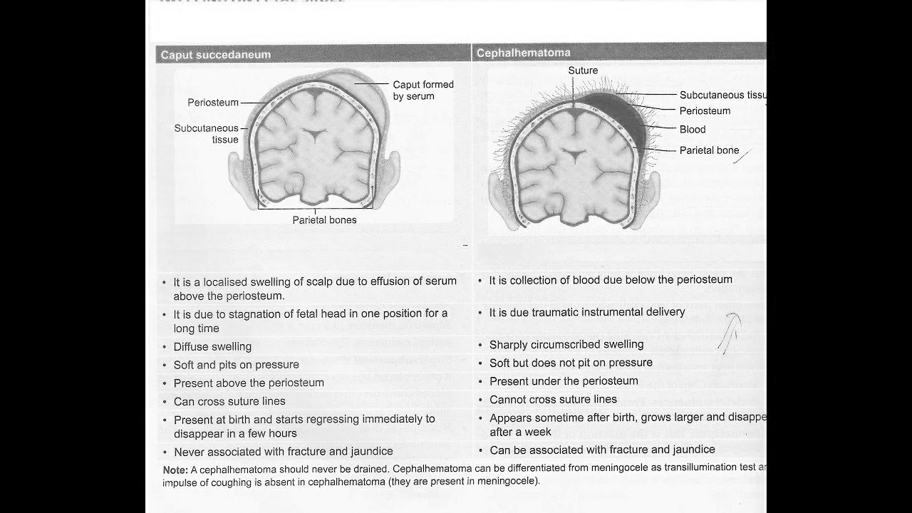 Caput Succedaneum Vs Cephalohematoma Why Does My Baby's Head Look